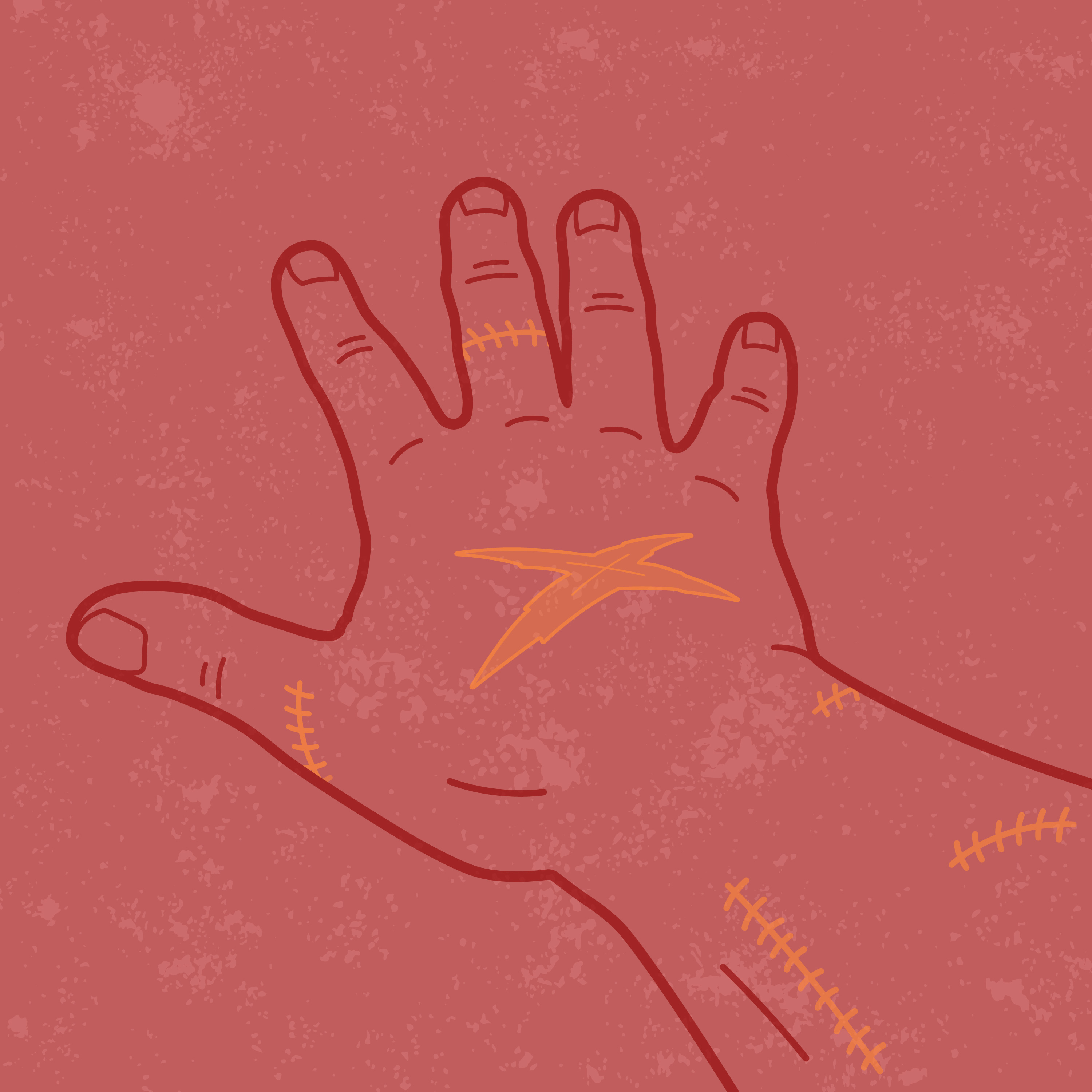 Graphic showing hand and wrist with scabs and scars